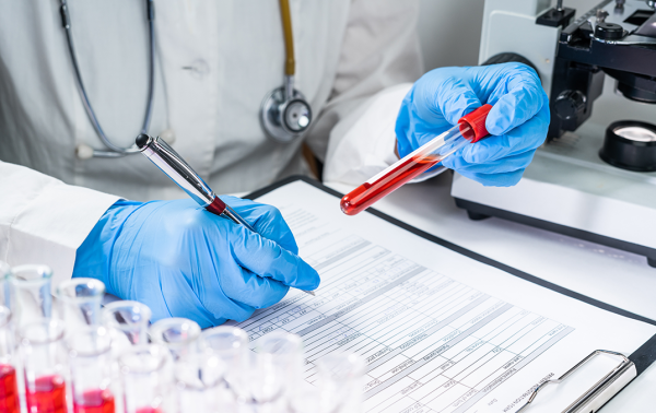 Blood Test Services and Clinics in Singapore
